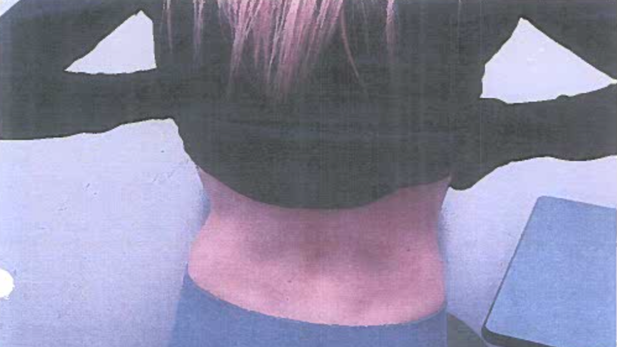 Colleen Crowley Injury Photos