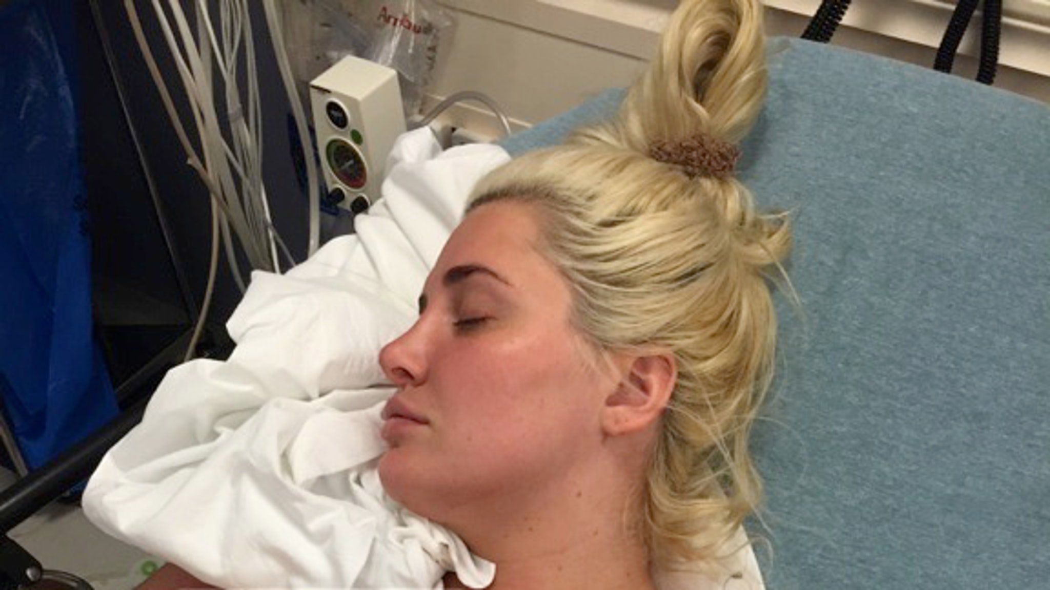 Shannon Twins' Car Crash Injury Photos