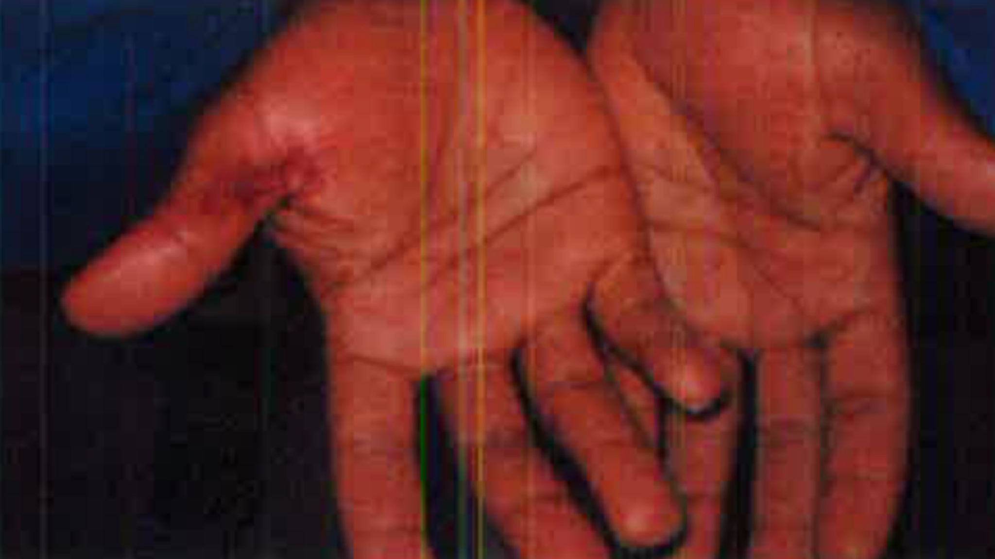 Early Doucet -- The 2017 Incident Photos