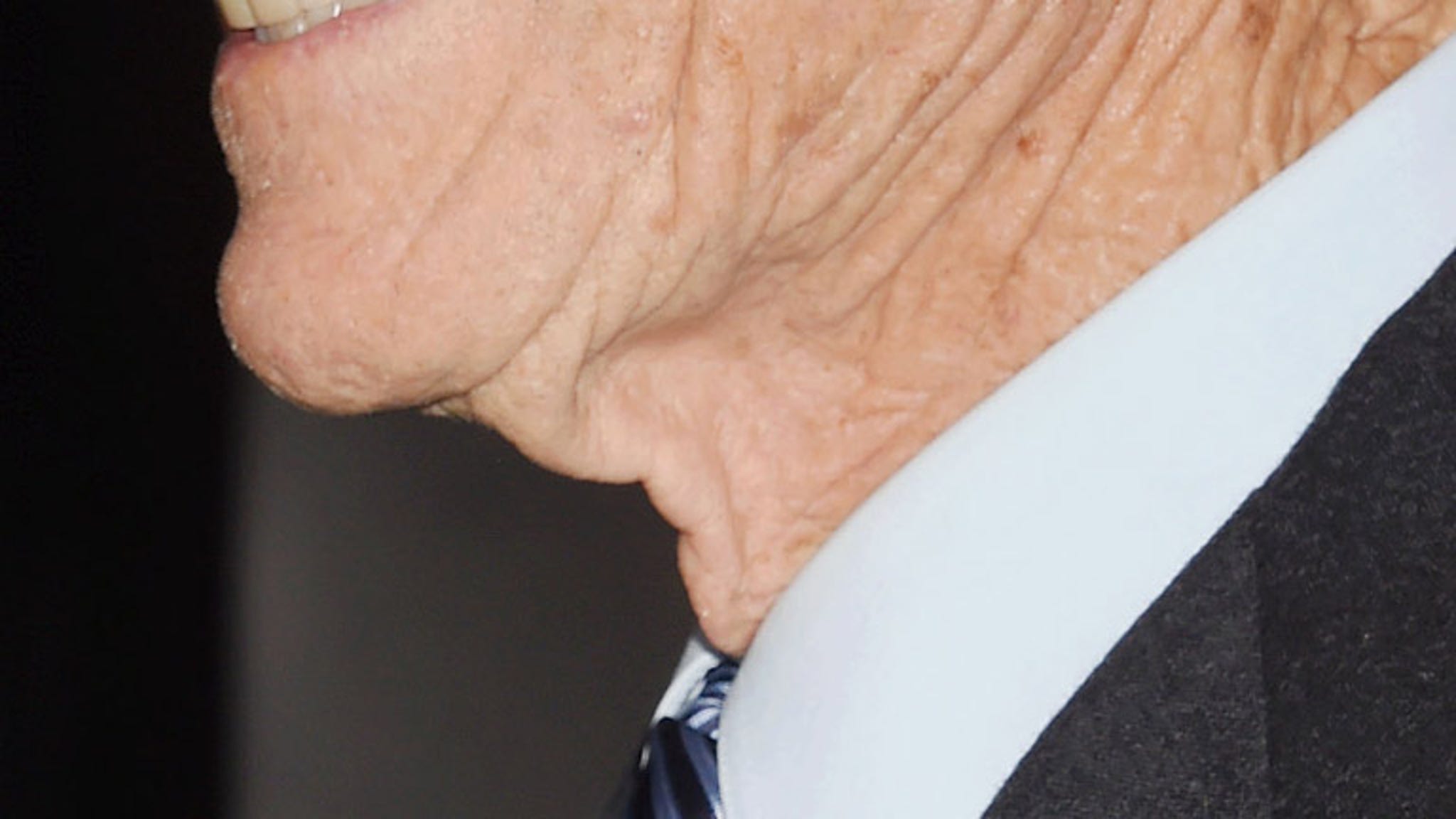 Celebrity Turkey Necks -- Guess Who!