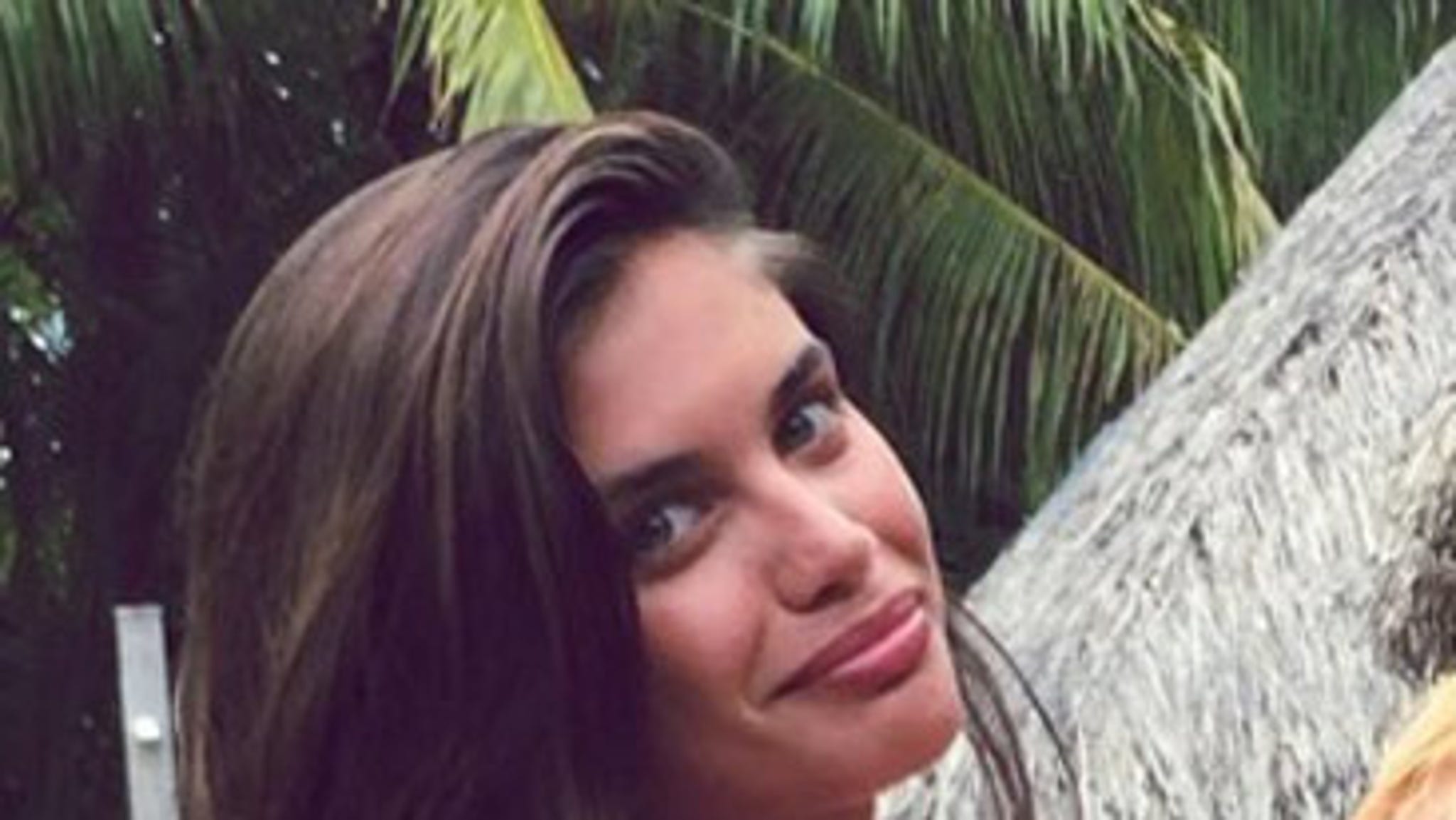 Celebrity Sunburns -- Guess Who!
