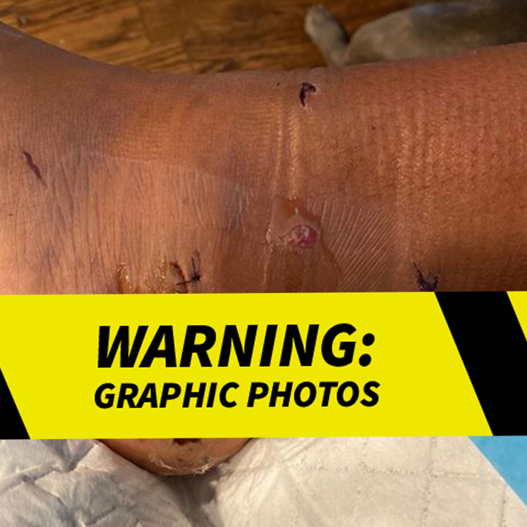 Megan Thee Stallion Scar On Foot Discount | emergencydentistry.com