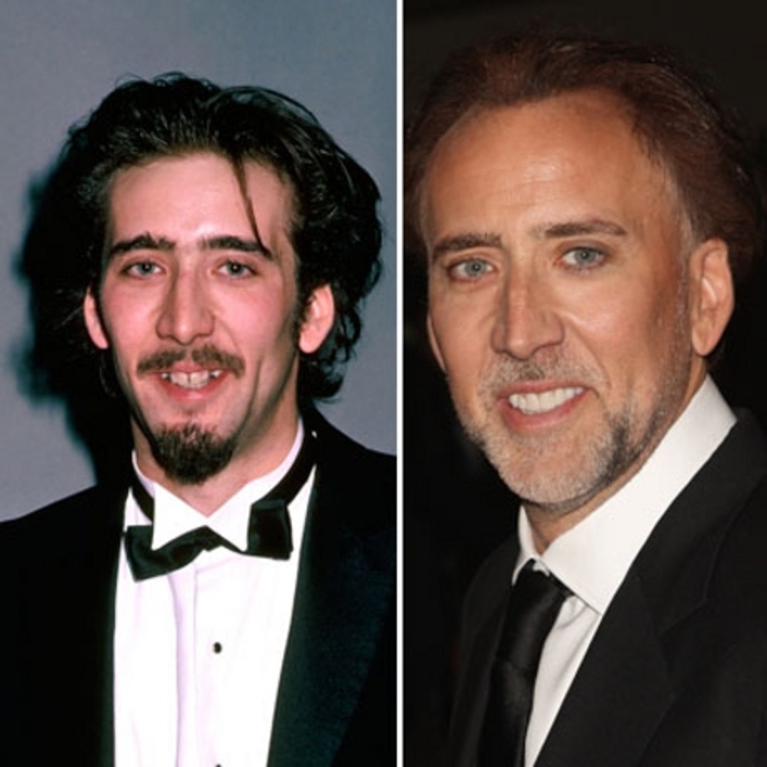 Young Nicolas Cage Teeth Nicolas Cage's Teeth: Are They His Own?
