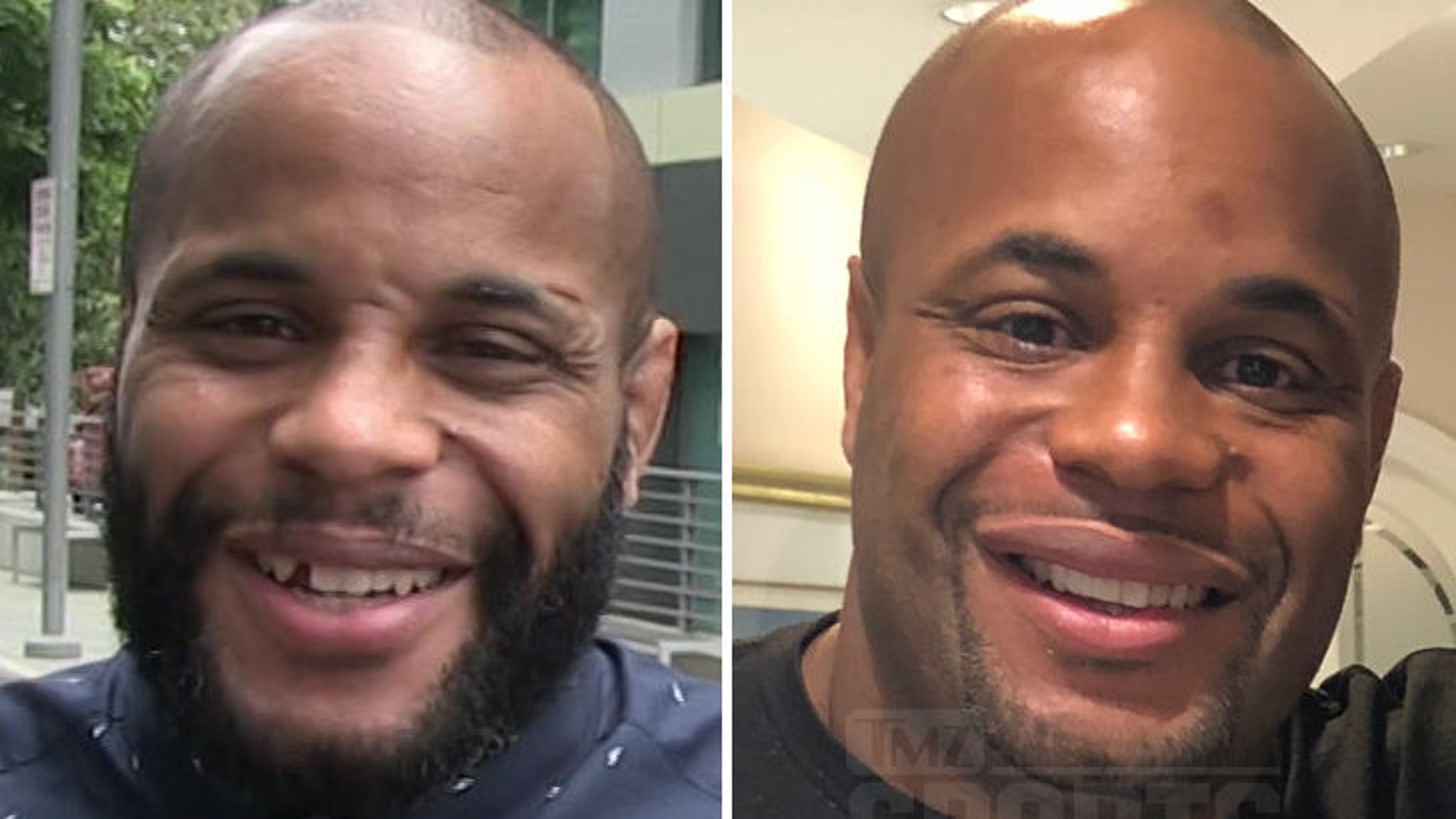 dan henderson front teeth