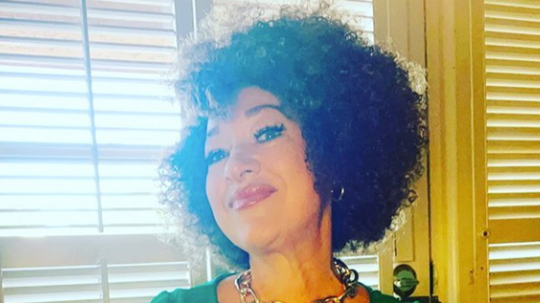 Rachel Dolezal Through The Years