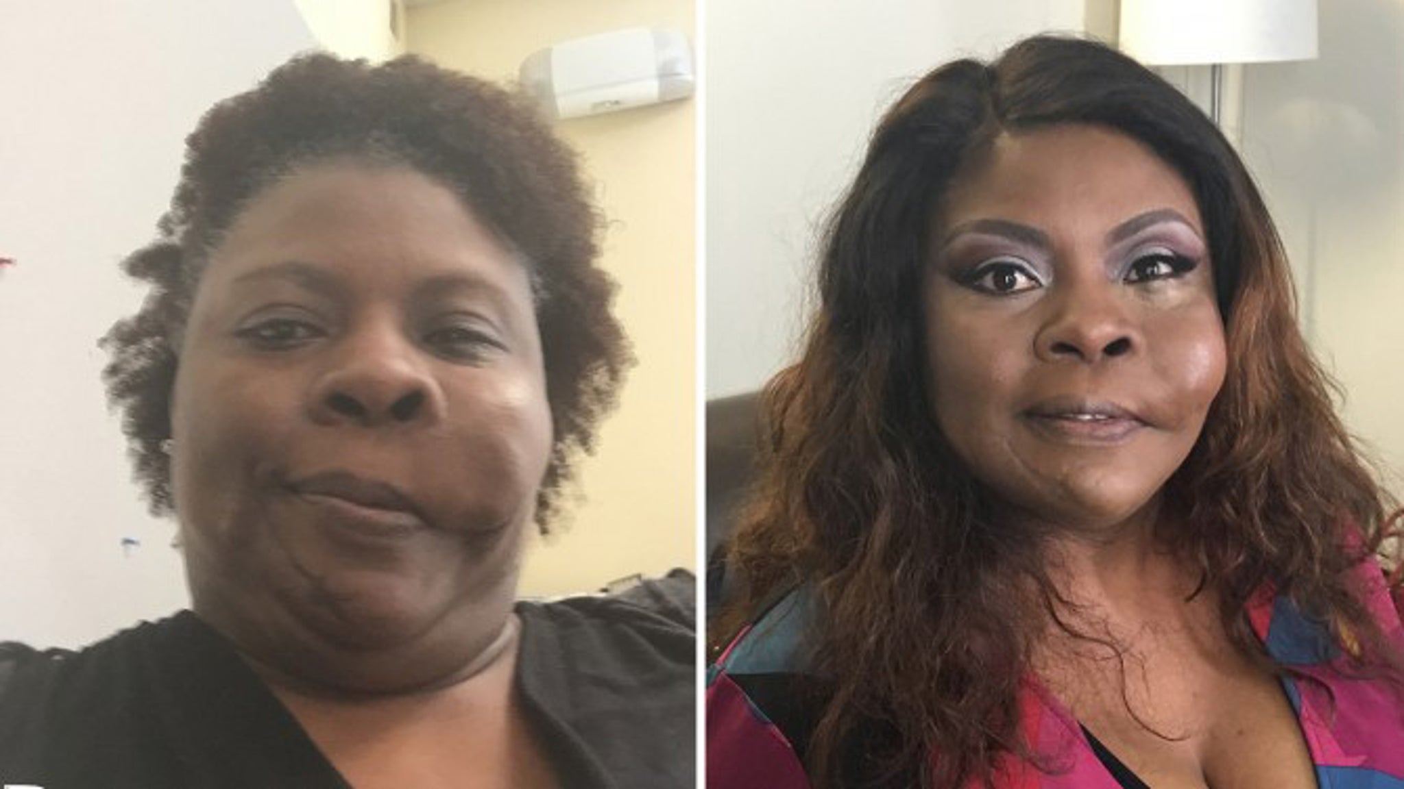 Face Forward -- Before and After