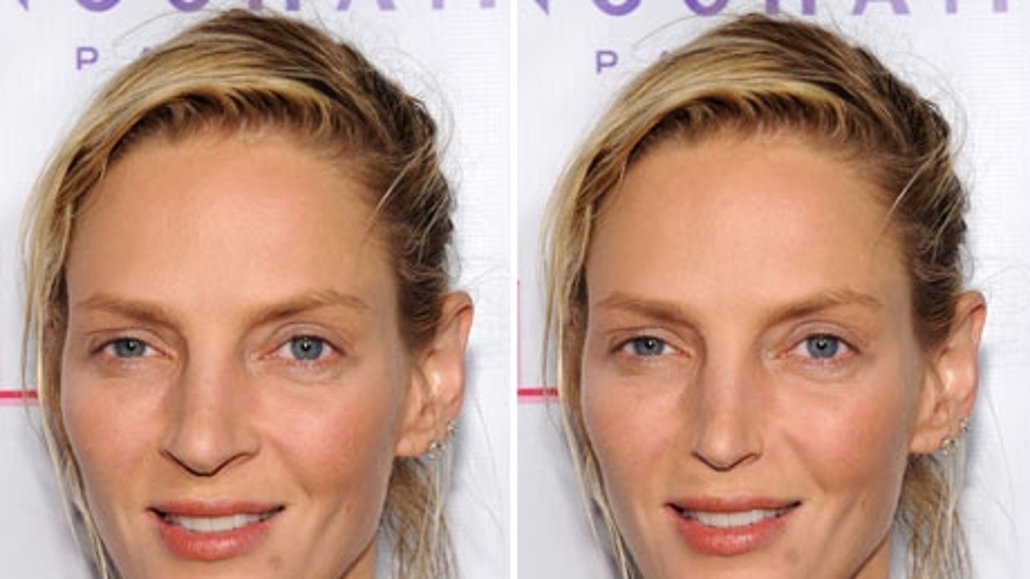 Celebrity Shnoz's -- Is Bigger Better?