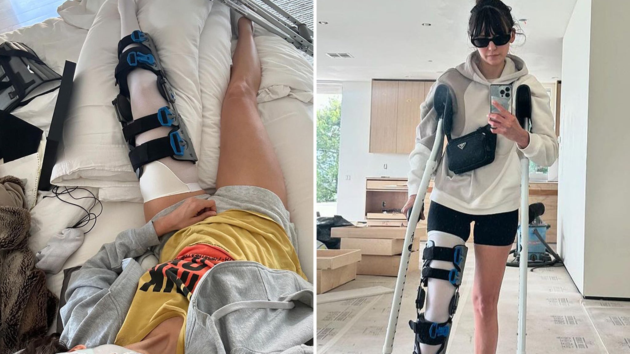 Nina Dobrev Injury Pics