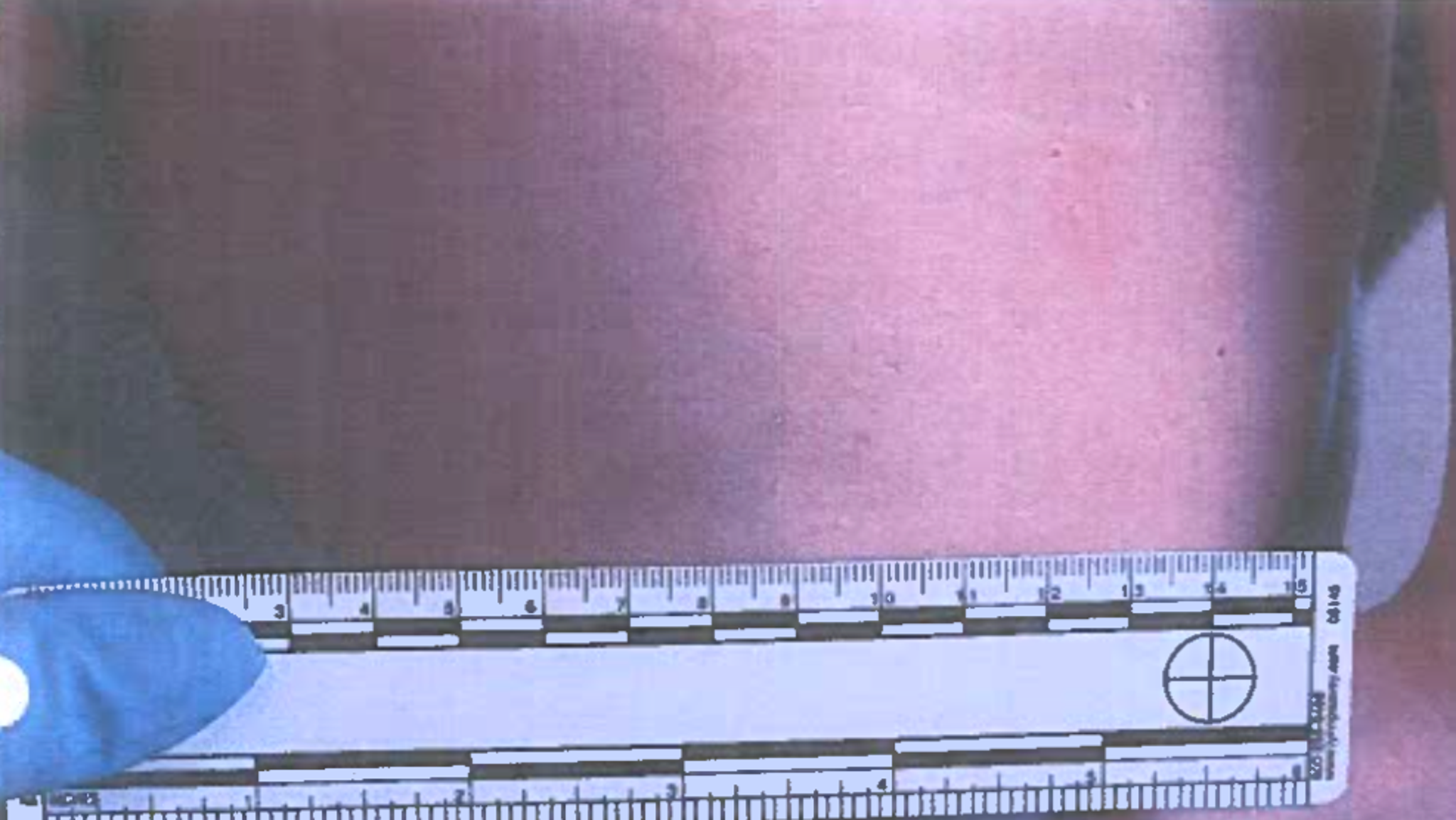 Colleen Crowley Injury Photos