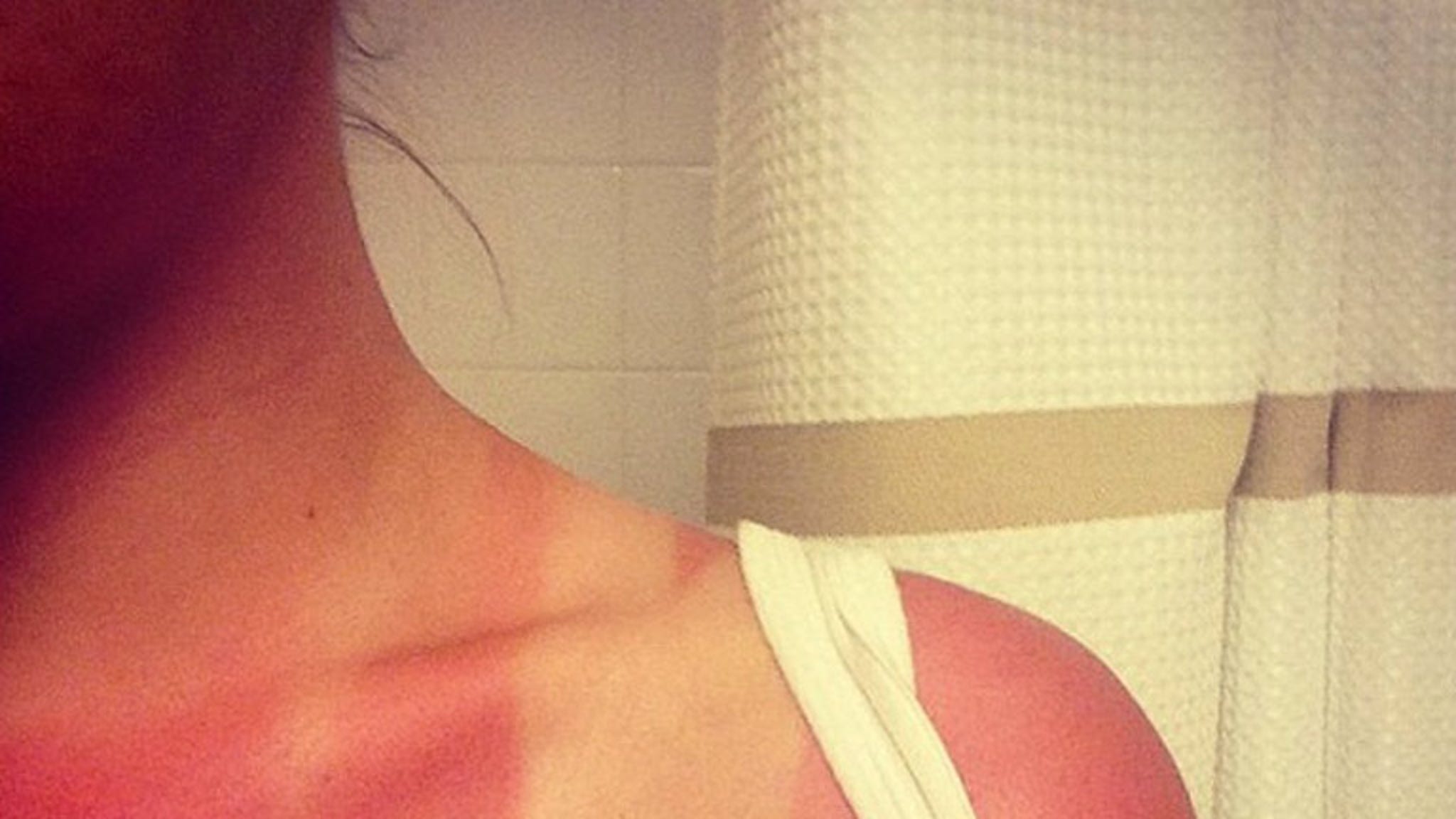 Celebrity Sunburns -- Guess Who!