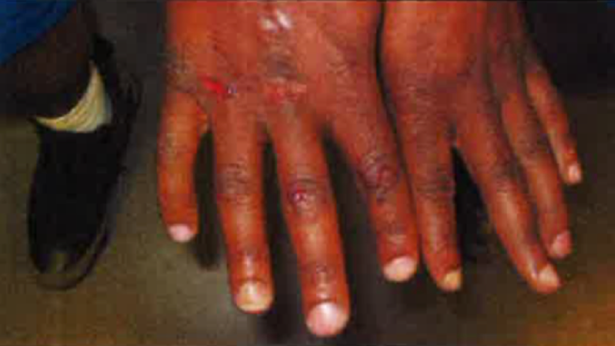 Early Doucet -- The 2017 Incident Photos