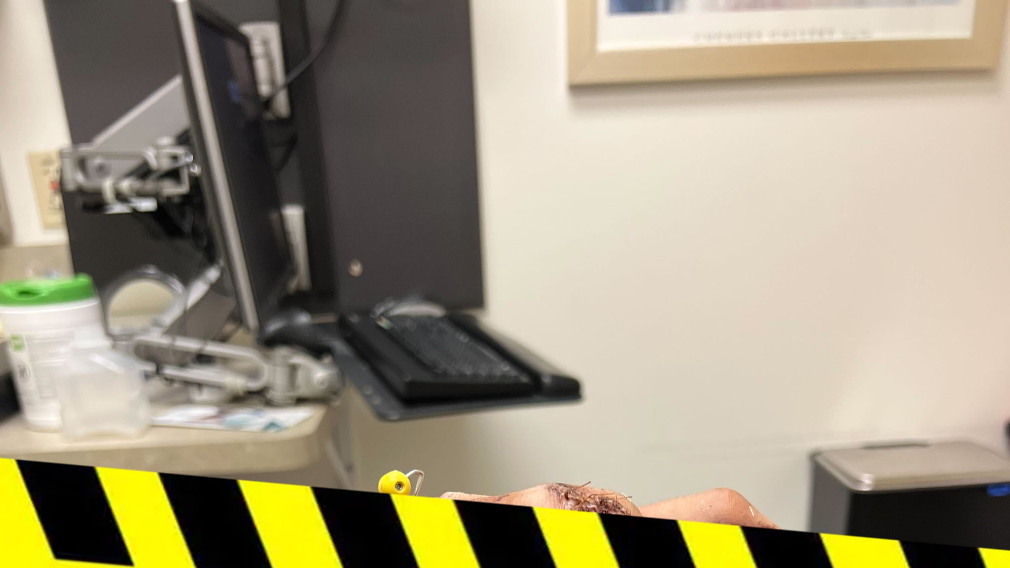 Dodger Fan Hand Injury Progress