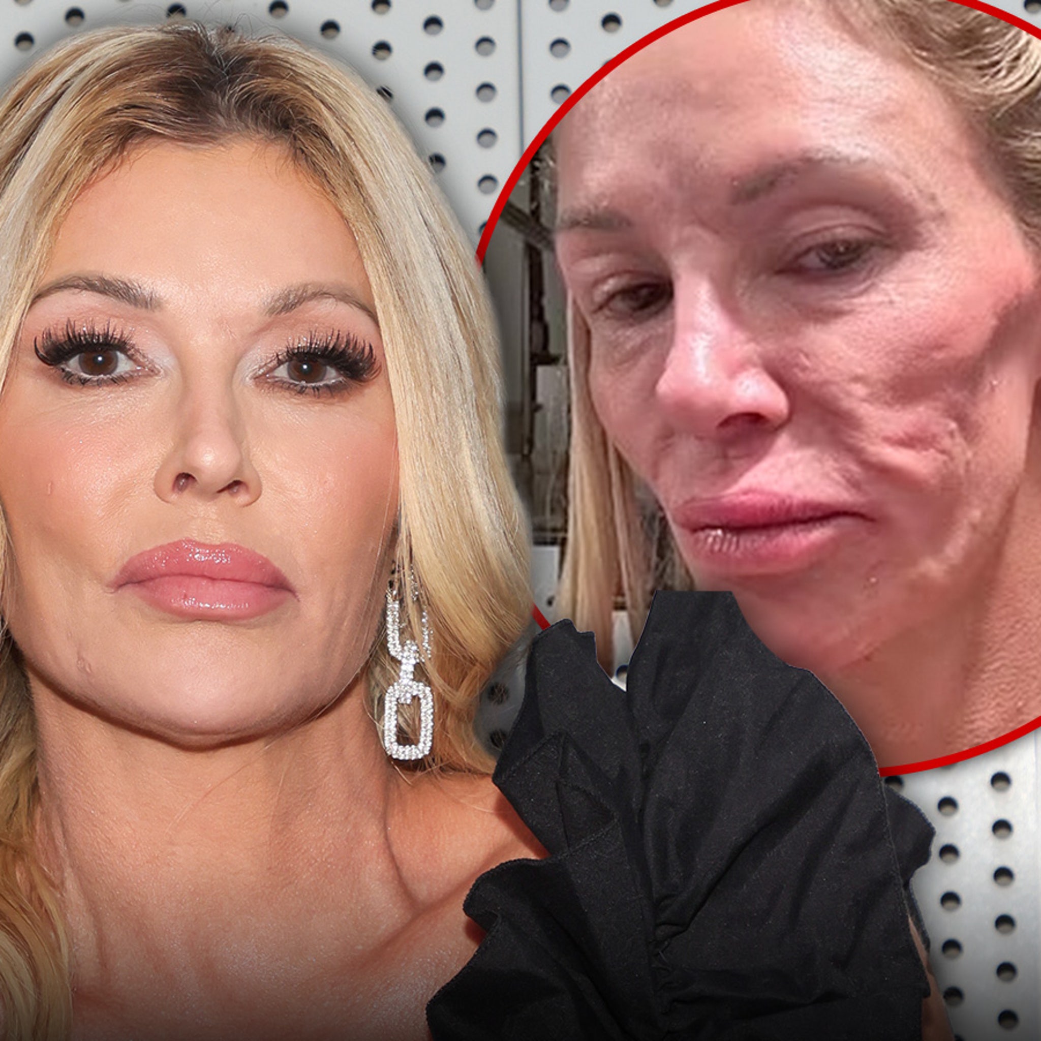 Brandi Glanville Prima E Dopo Brandi Glanville Before And After