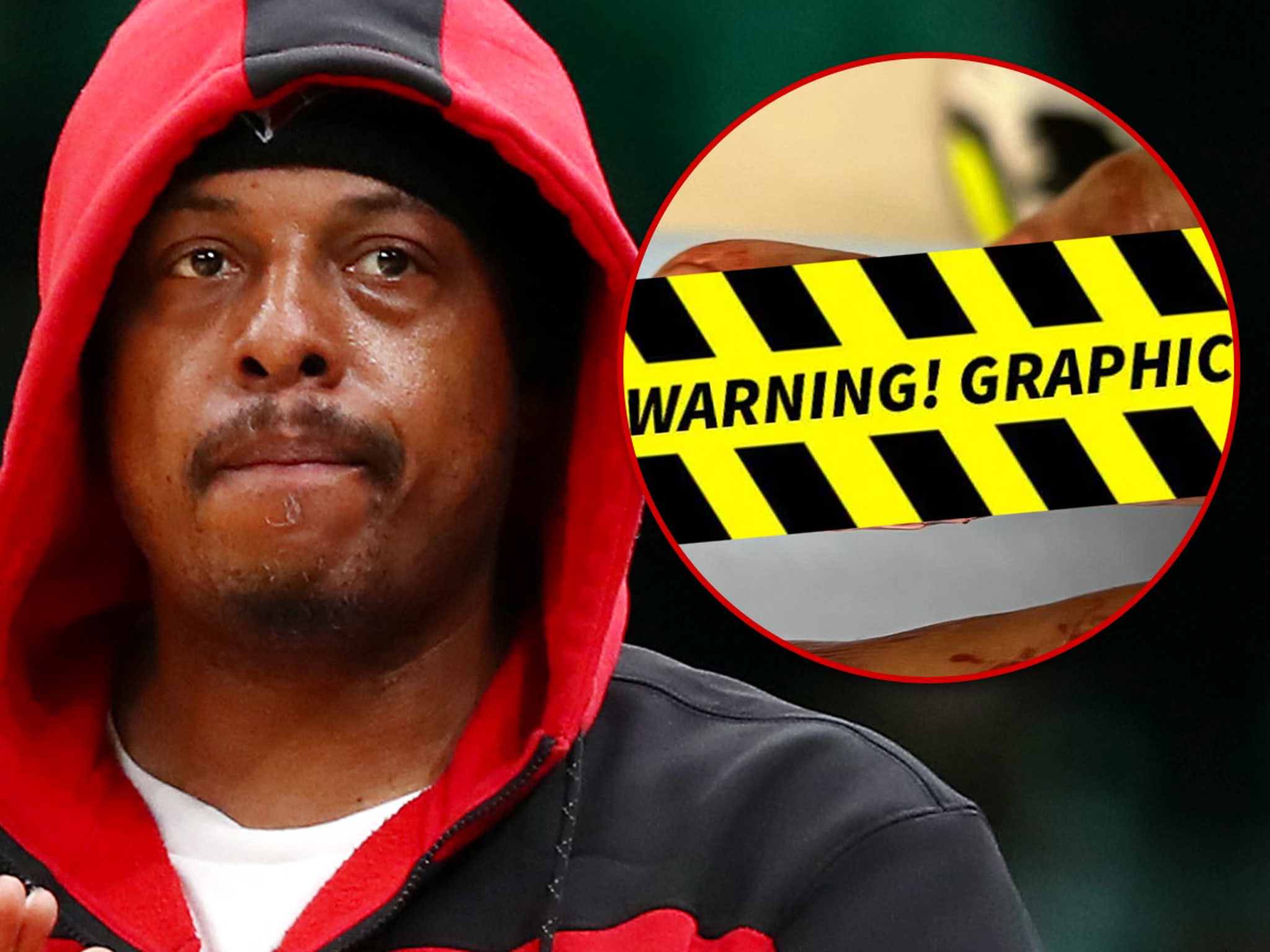 Paul Pierce Gordo Paul Pierce Hospitalized With Gruesome Finger Injury