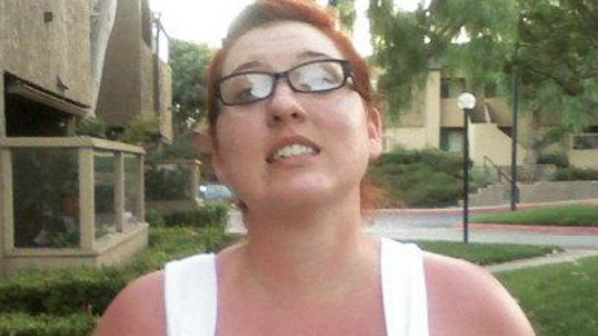 TMZ's Summer Sunburn Snapshots Contest