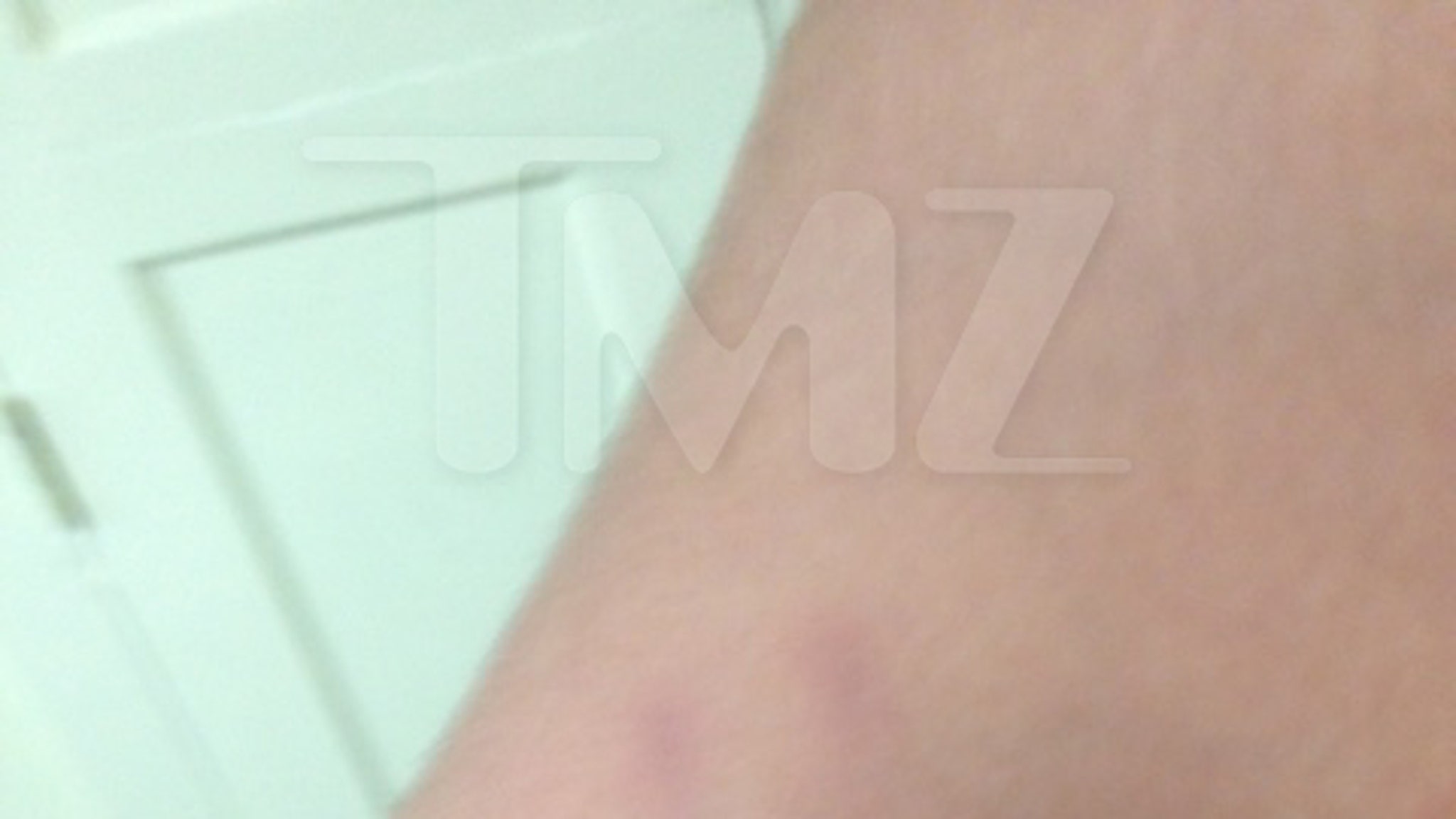 Nick Gordon Alleged Injuries