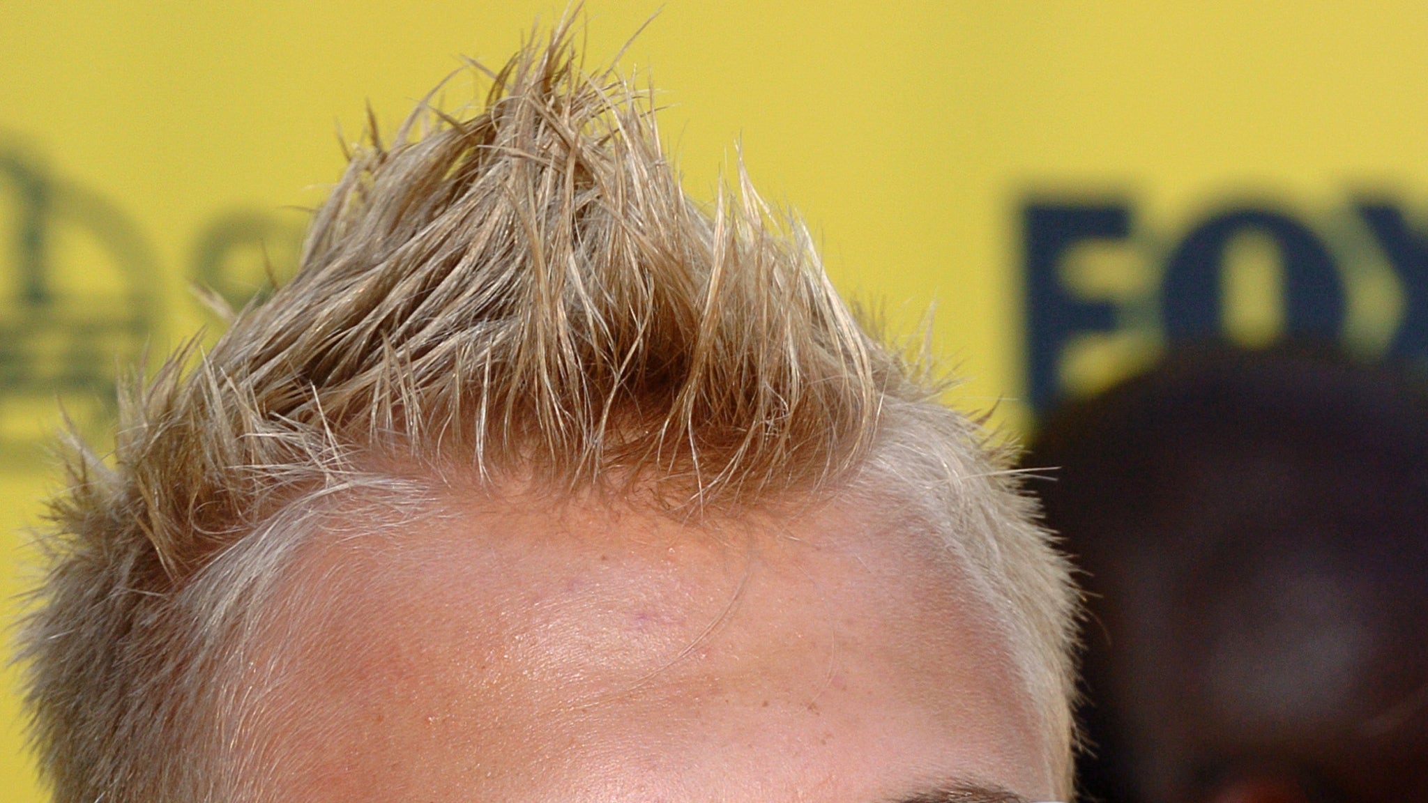 Nick Hogan Through the Years