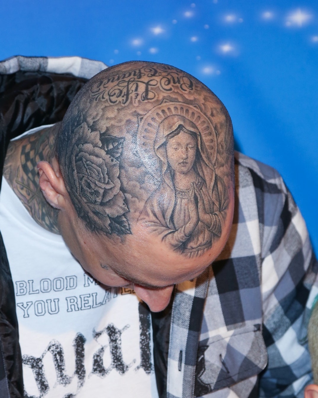 Tatuagens De Travis Barker Removidas Travis Barker Tattoos Transplants