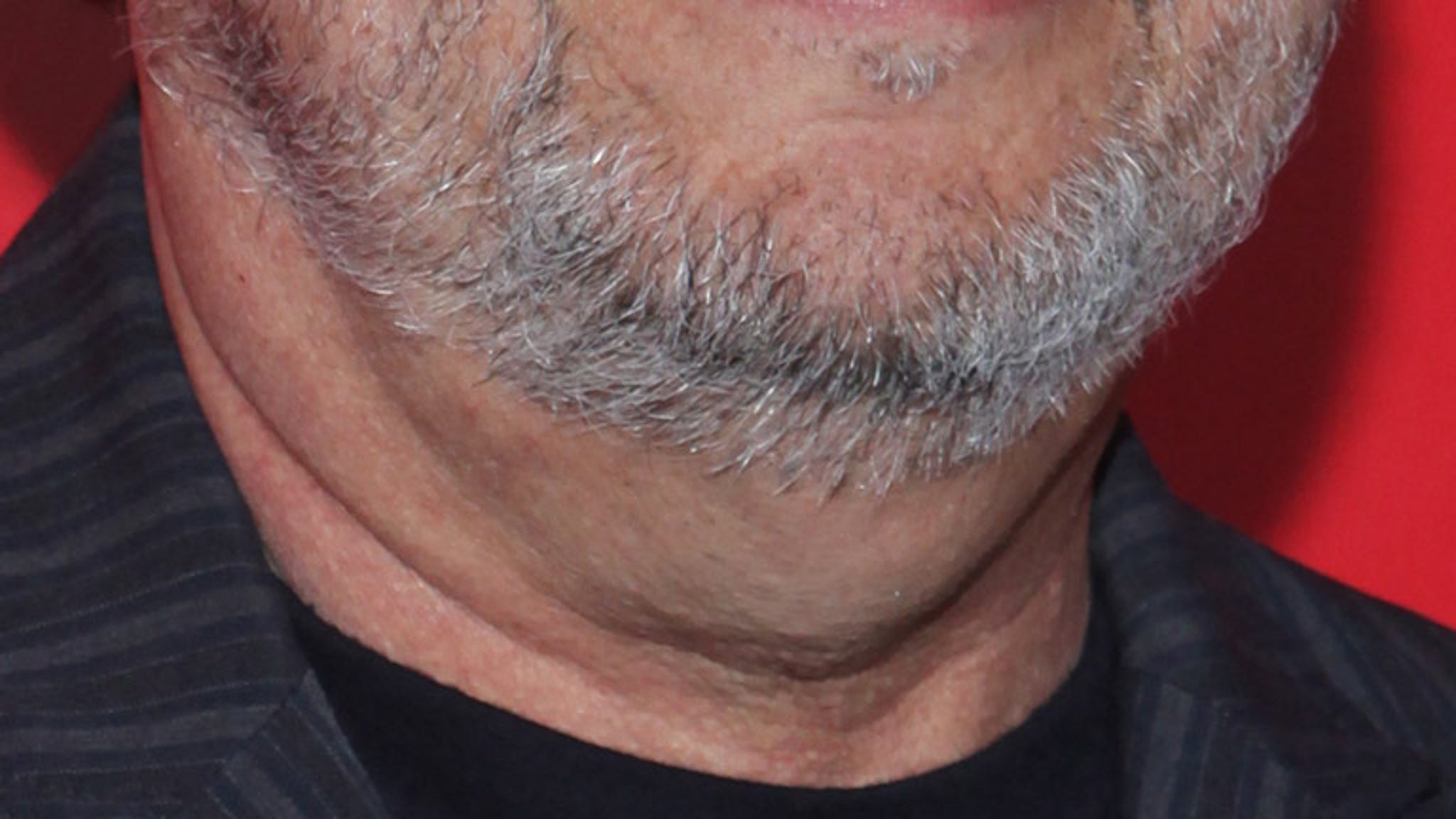 Celebrity Turkey Necks -- Guess Who!