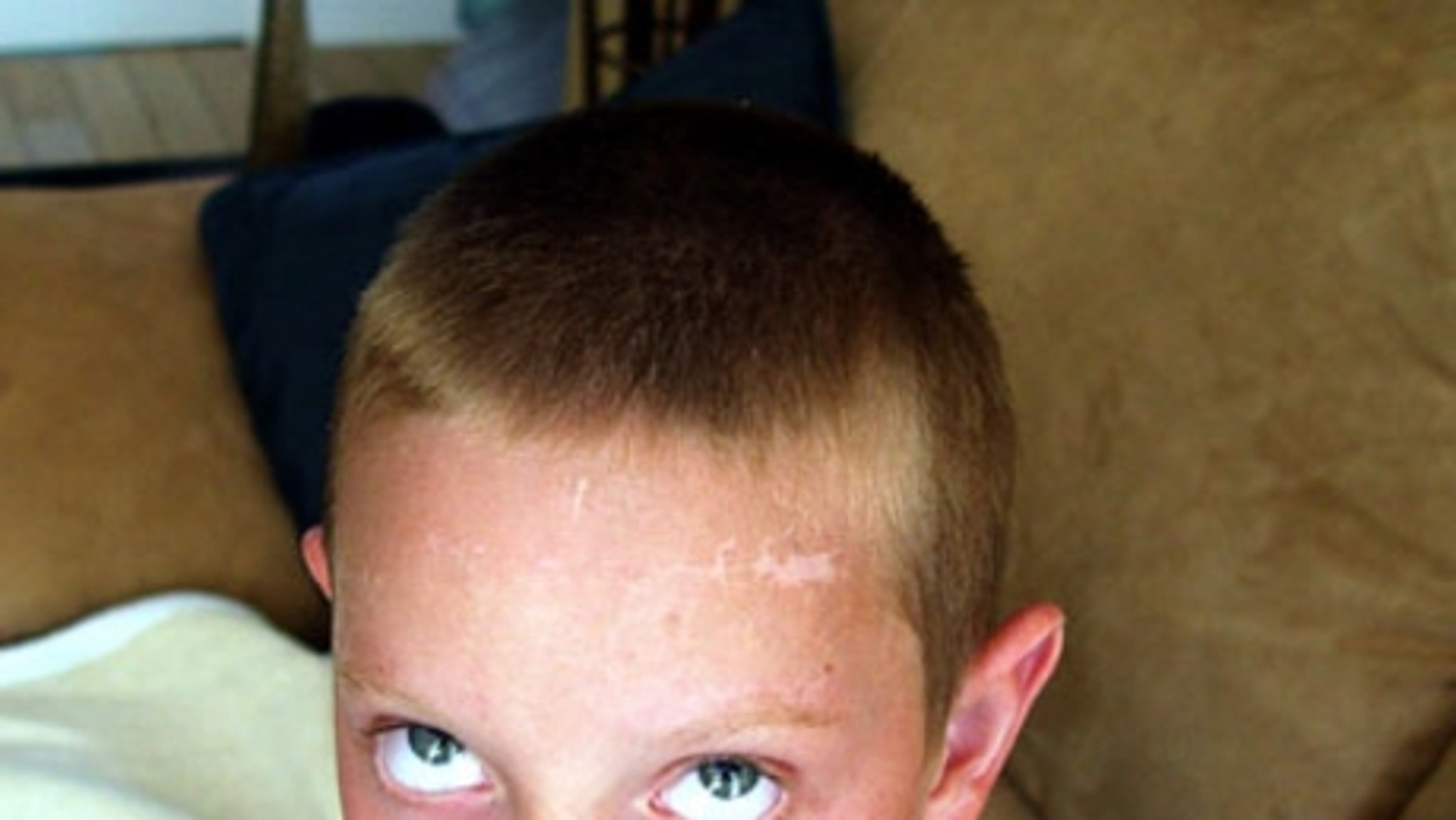 TMZ's Summer Sunburn Snapshots Contest