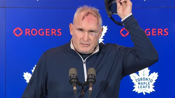 Toronto Maple Leafs Coach Craig Berube Reveals Nasty Scar From Gym Accident