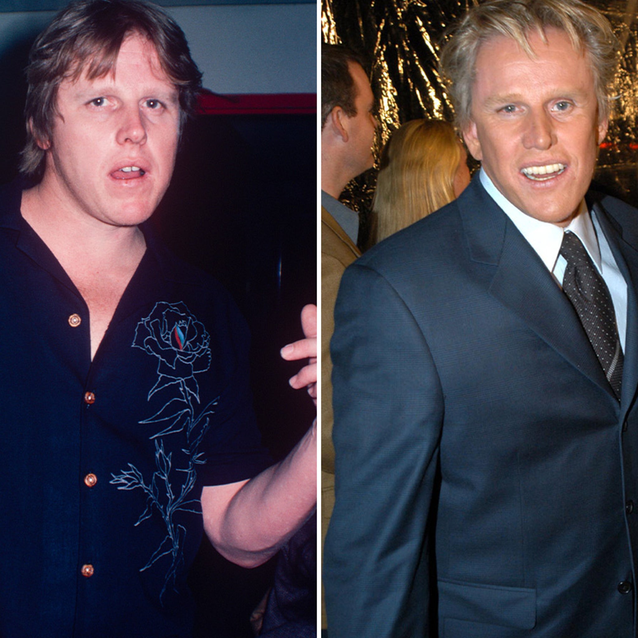 Gary Busey Antes E Depois